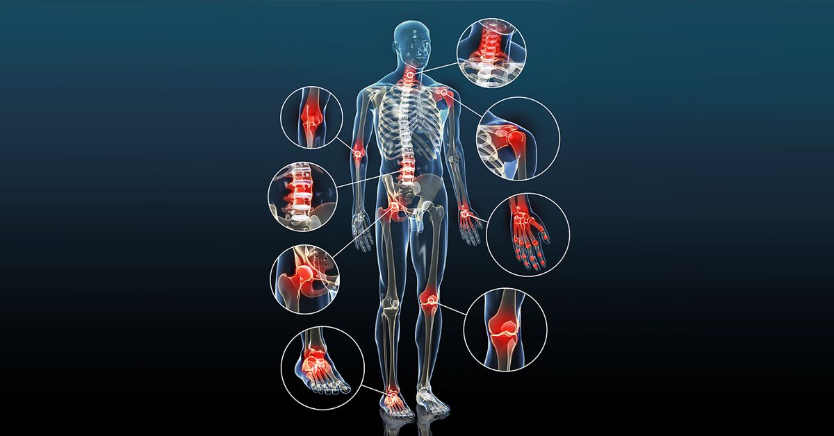 Arthrose / Gelenkverschleiss - Ursache, Diagnose und Behandlung - KSW