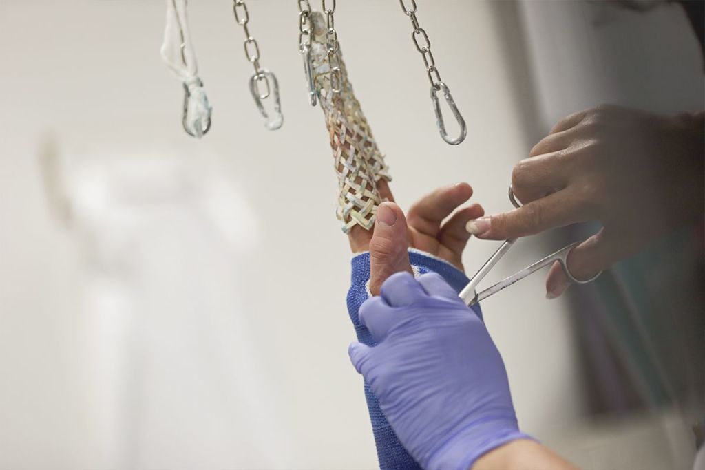 Alles rund um den Gips - Notfallzentrum - Kantonsspital Winterthur KSW