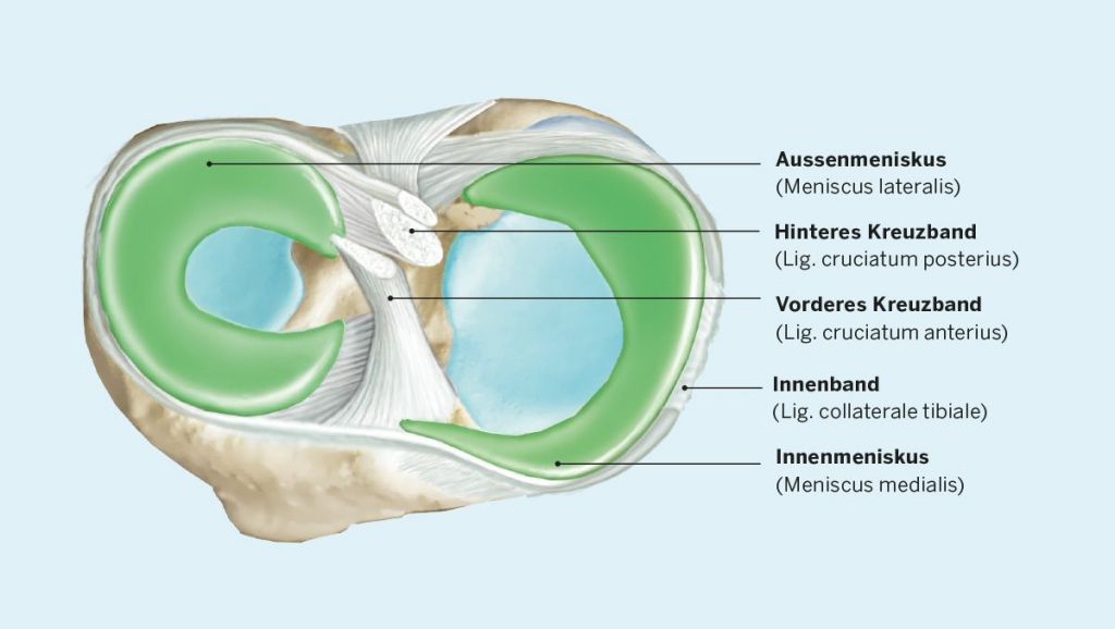 Kniespiegelung beim Meniskusriss - Behandlung - KSW