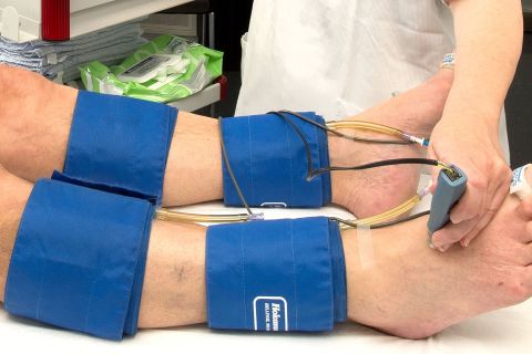 Lymphödem - Ursachen und Behandlung | Kantonsspital Winterthur